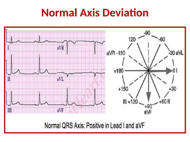 lecture on cardiac Axis on ecg for nurses | PPT