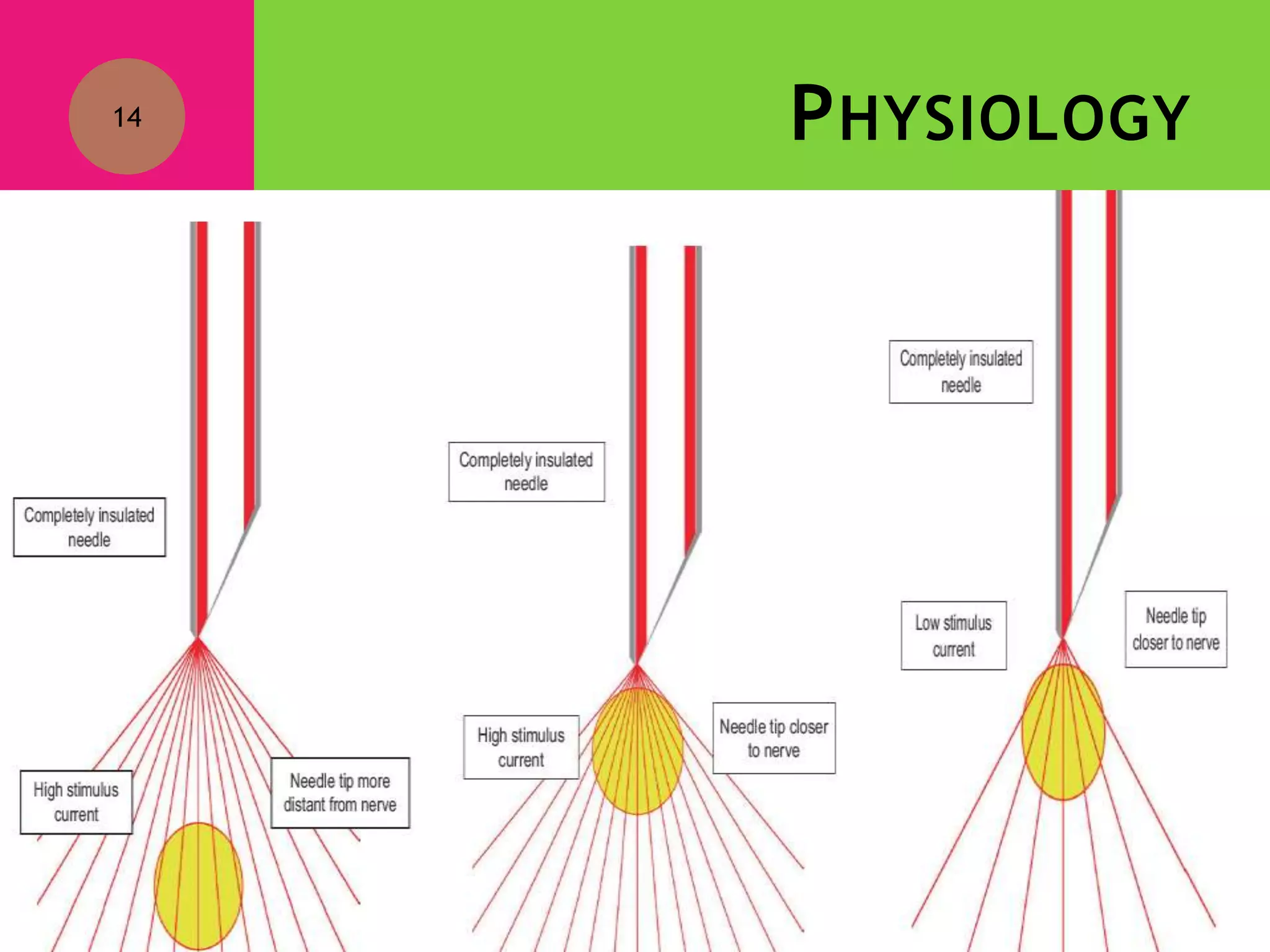 Peripheral Nerve Block Part 1 | PPTX