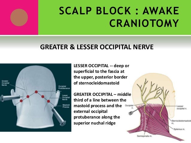 Peripheral Nerve Block Part 1