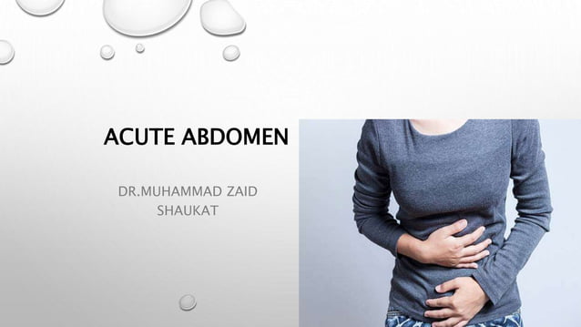 ACUTE ABDOMEN | PPT