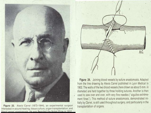 Free Functional Muscle Transfer | PPTX | Death, Injury, or Military ...