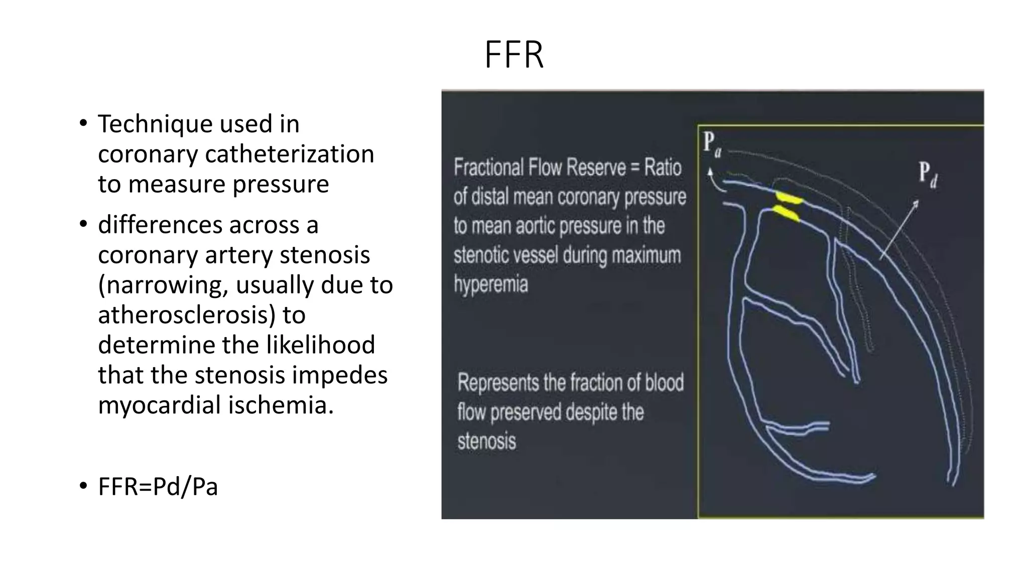 FFR(fractional flow reserve) | PPTX