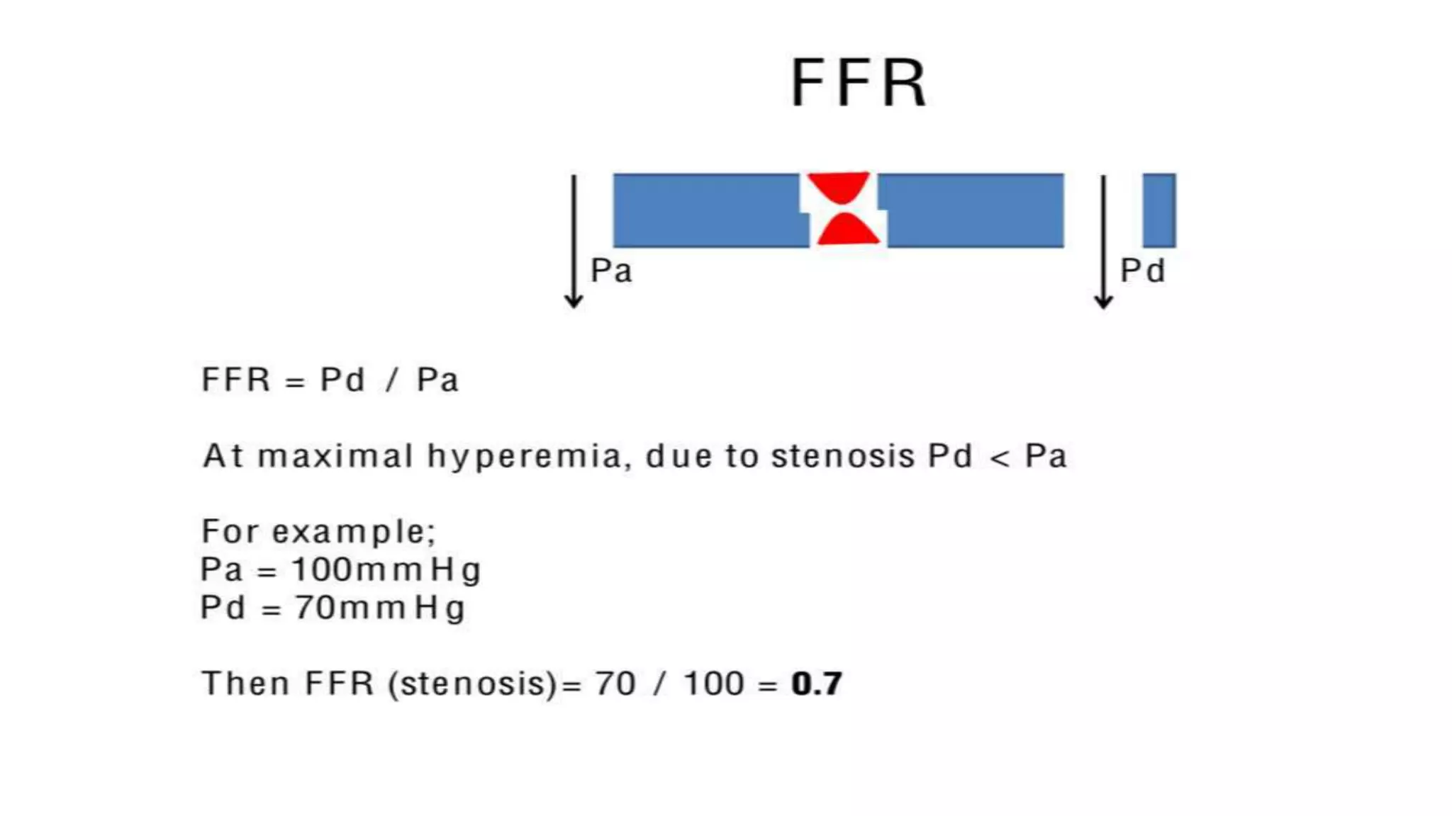 FFR(fractional flow reserve) | PPTX
