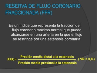 Reserva de Flujo Fraccional coronario 2013 | PDF