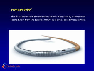 Value of FFR in clinical practice | PPT