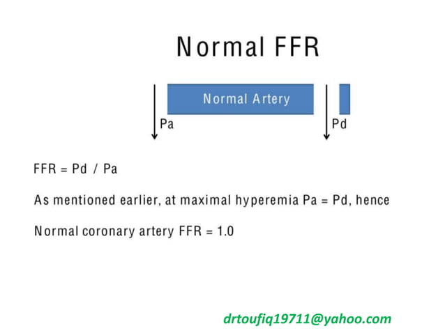fractional flow reserve FFR dr md toufiqur rahman FSCAI FAHA FAPSIC | PPSX
