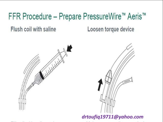 fractional flow reserve FFR dr md toufiqur rahman FSCAI FAHA FAPSIC | PPSX