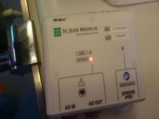 FFR with St. Jude System | PPTX