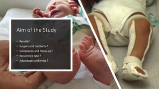 French Functional Method for Congenital Clubfoot: 20 years of ...