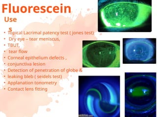 Staining of an eye (for students of optometry) | PPTX | Eye and Vision Conditions | Diseases and ...