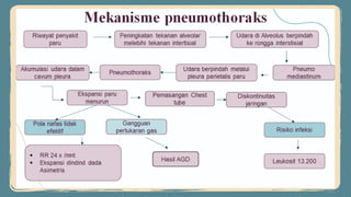 FG 4 - Revisi Pneumothorax_Kelas B RPL.pptx