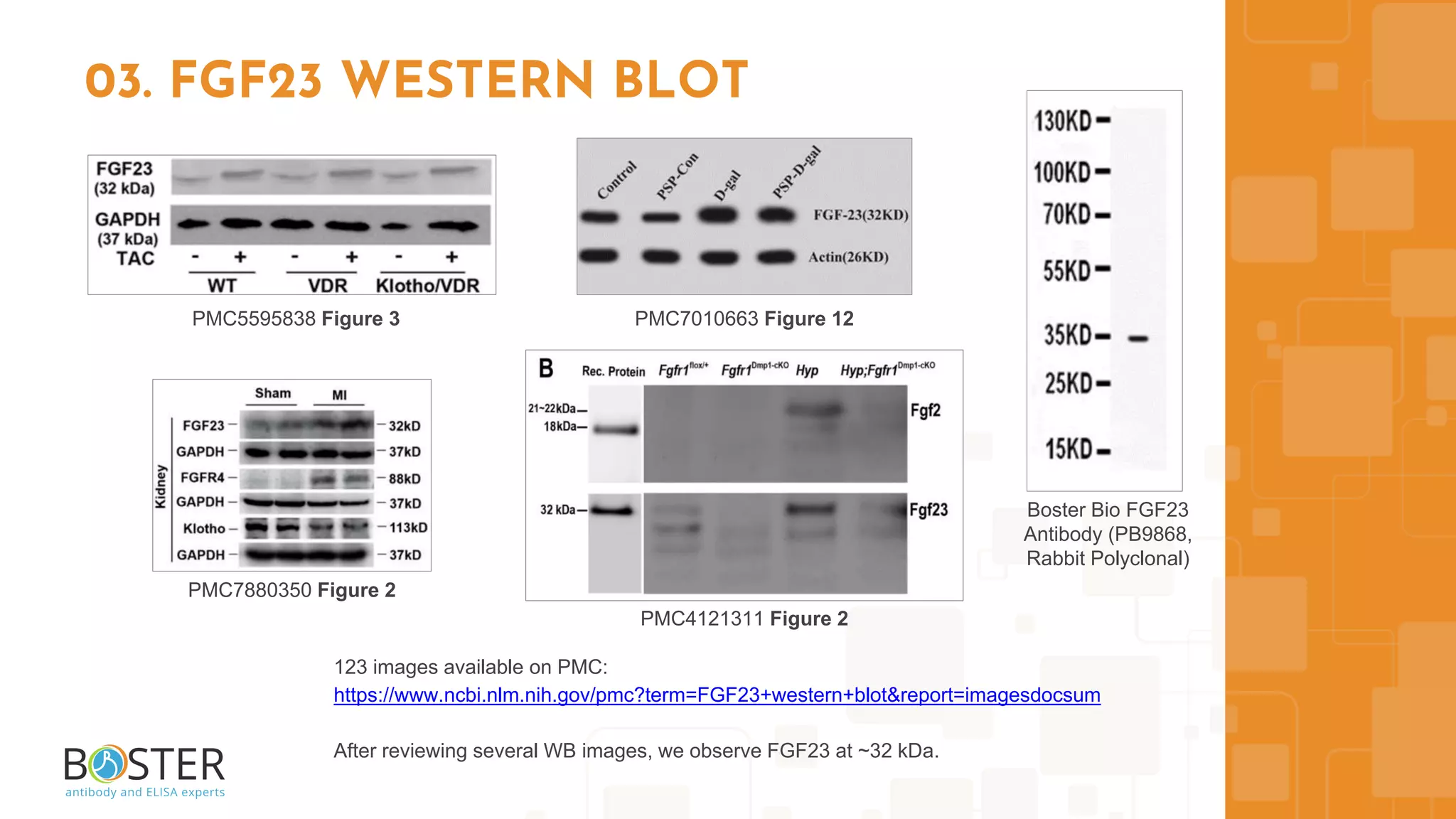 Learn FGF23 in 3 minutes | Fibroblast growth factor 23 | PPTX