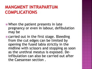 Female Genital Mutilation | PPTX