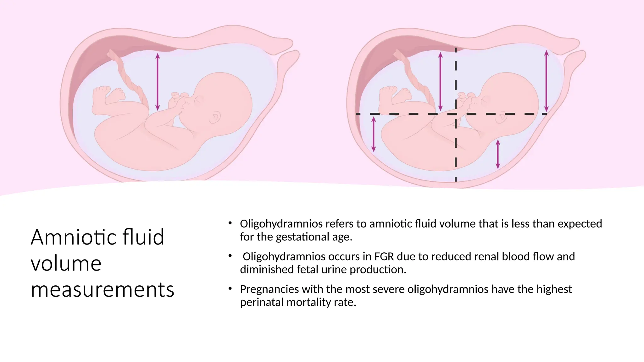 Diagnosis of fetal growth restriction.pptx