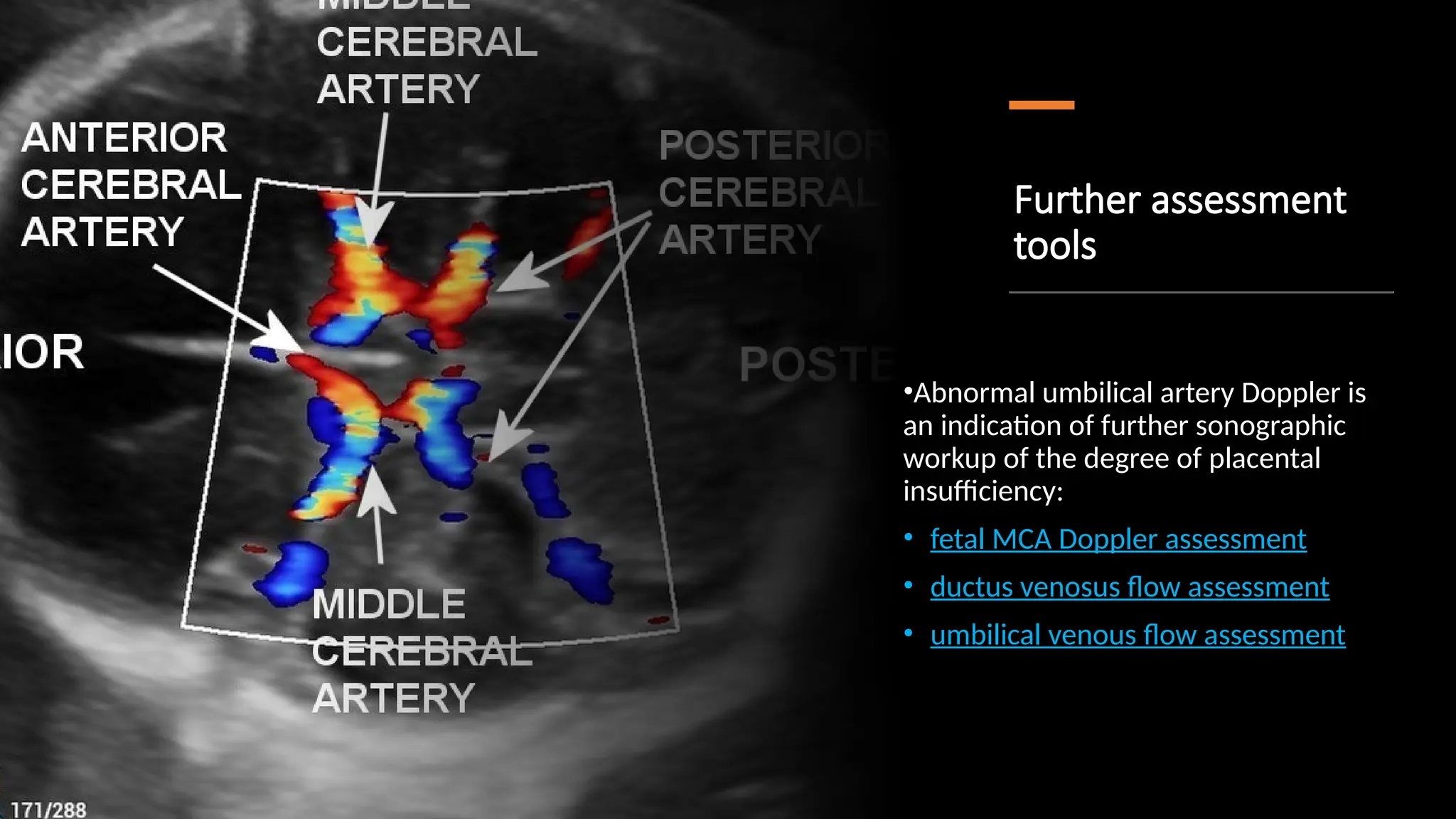 Diagnosis of fetal growth restriction.pptx