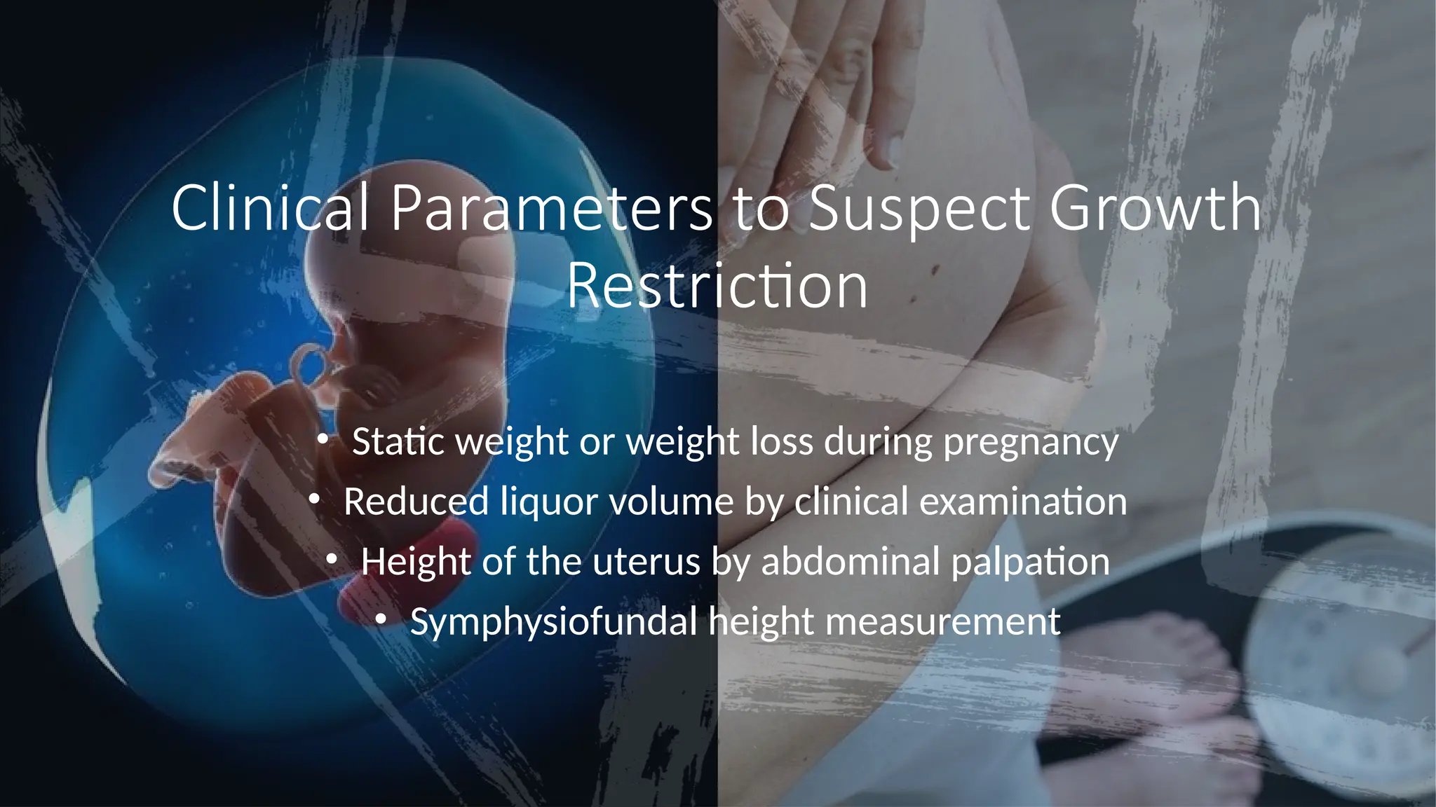 Diagnosis of fetal growth restriction.pptx