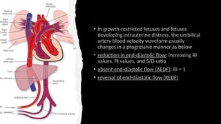 Diagnosis of fetal growth restriction.pptx
