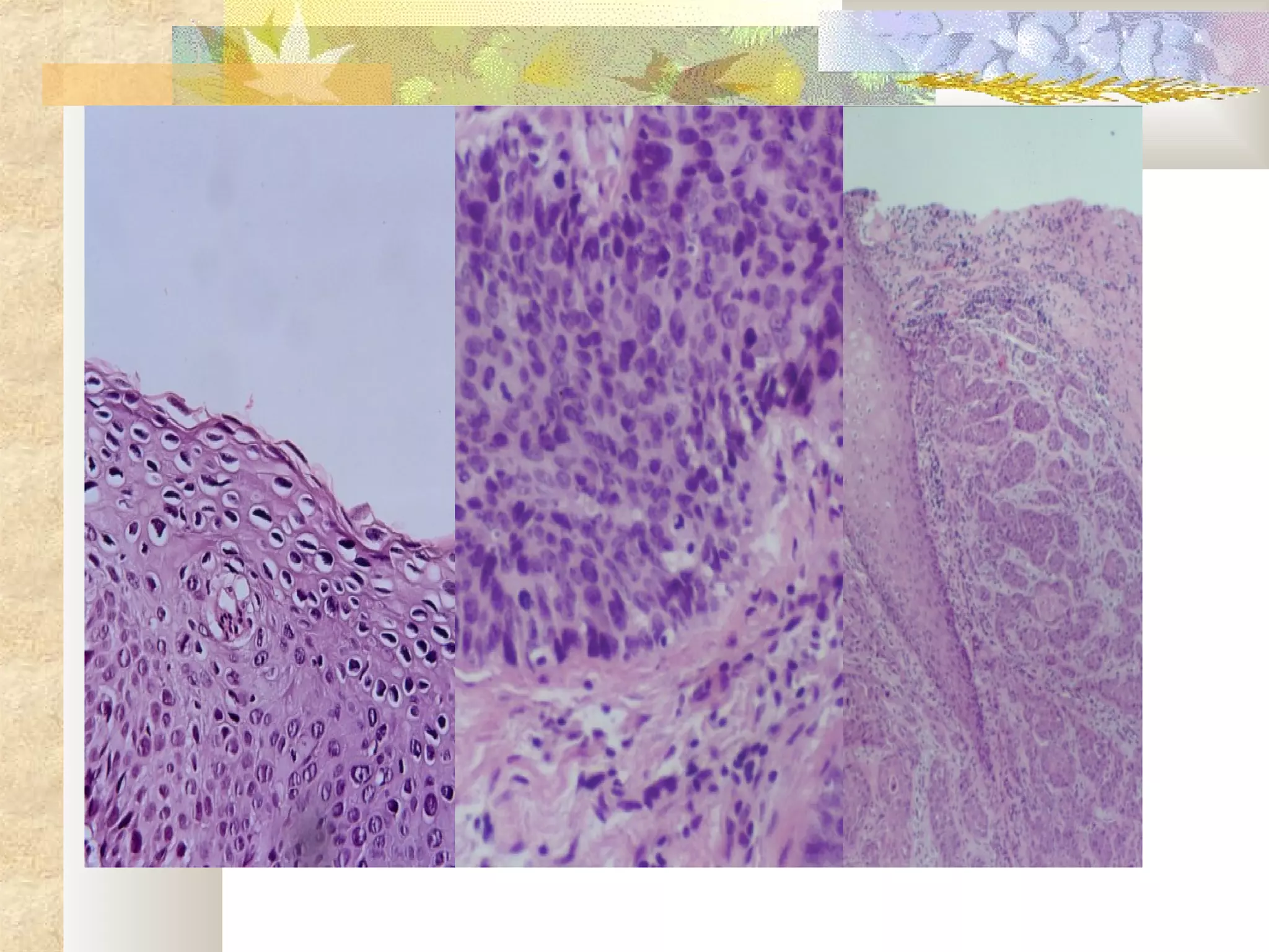 female genital system | PPT