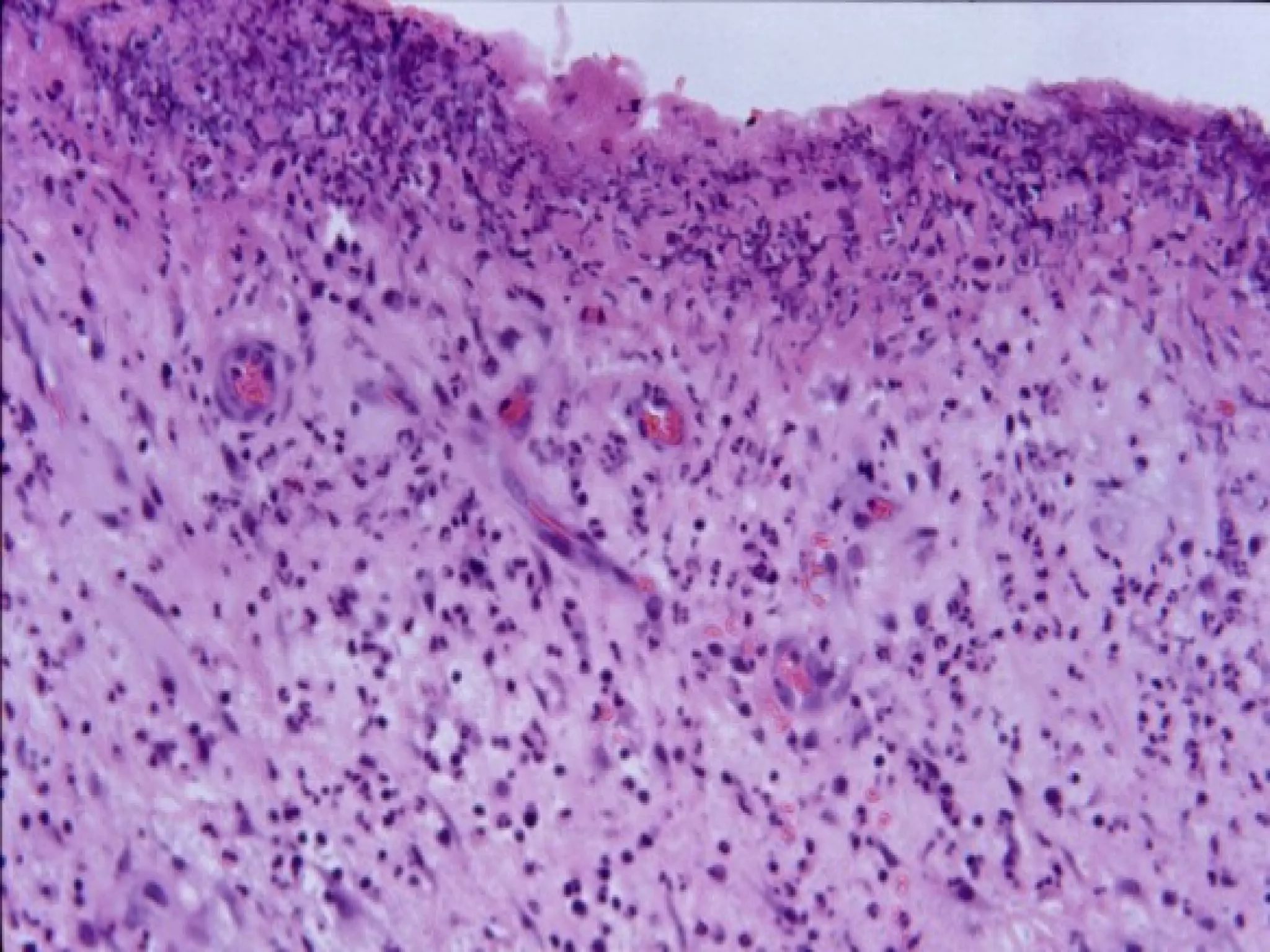 female genital system | PPT