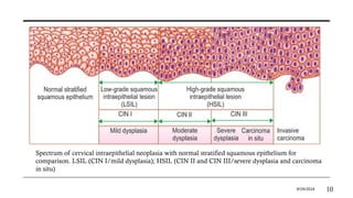 female genital tract presentation of pathology | PPT