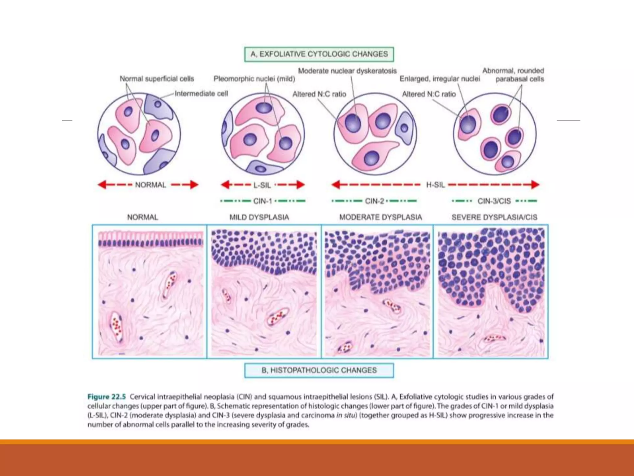 Fgt uterus and cervix | PPTX