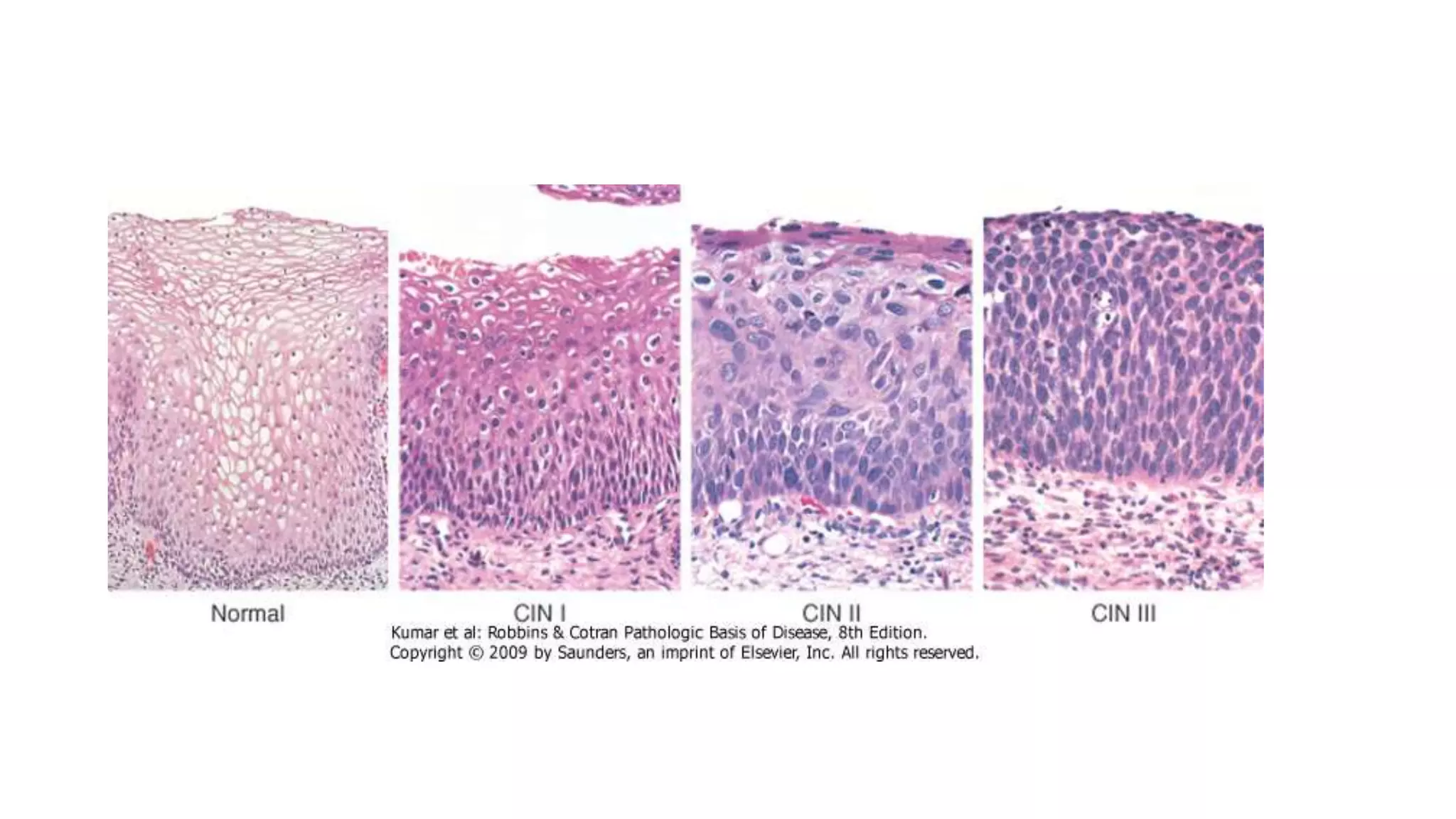 Female Genital Tract - Pathology | PPTX