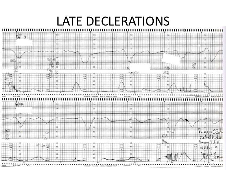 Fht interpretation & management