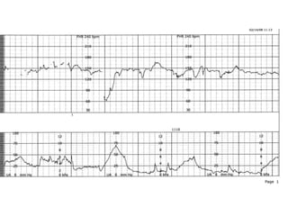 Fht interpretation & management | PPT