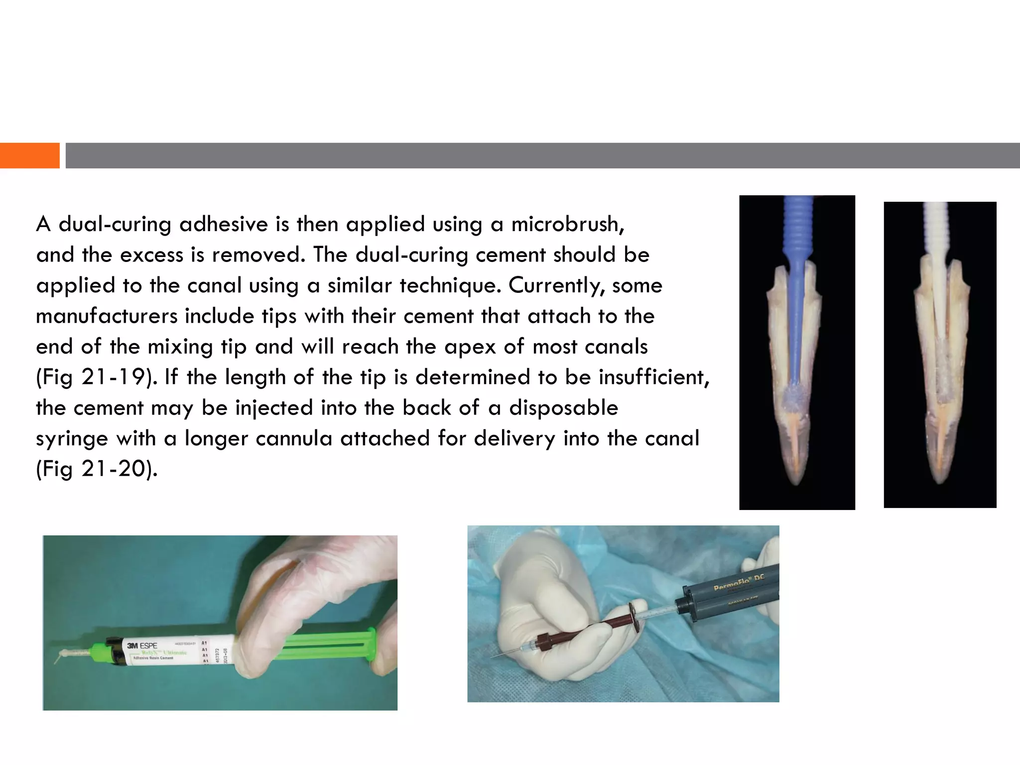 Fiber-reinforced composite posts.pdf