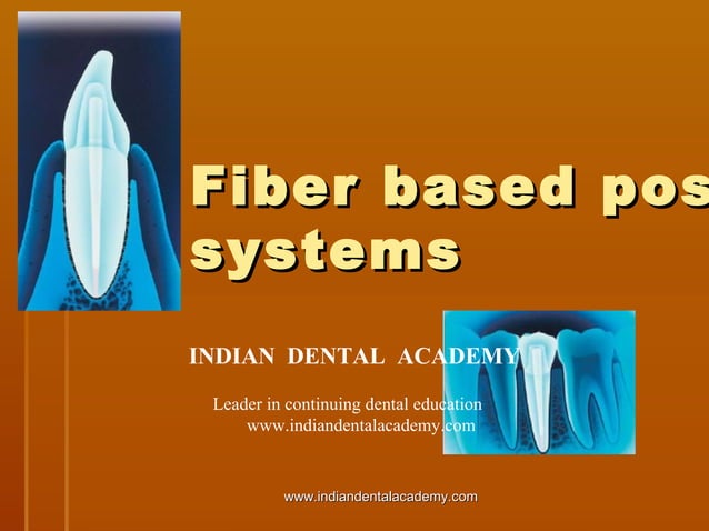 Fiber based post systems/ cosmetic dentistry training | PPT