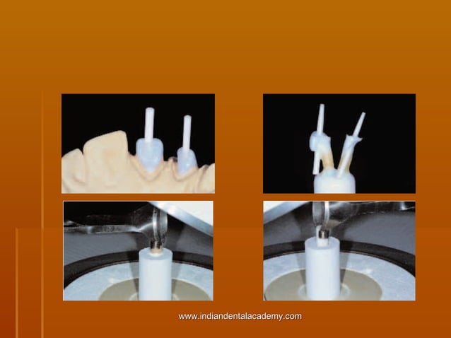 Fiber based post systems/ cosmetic dentistry training | PPT