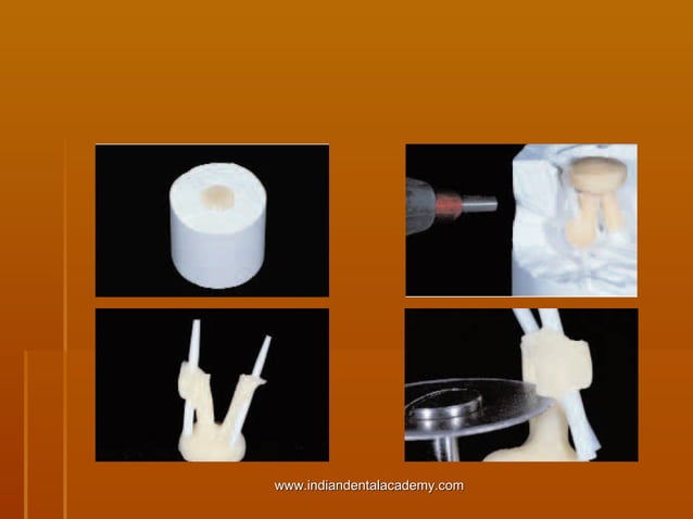 Fiber based post systems/ cosmetic dentistry training | PPT