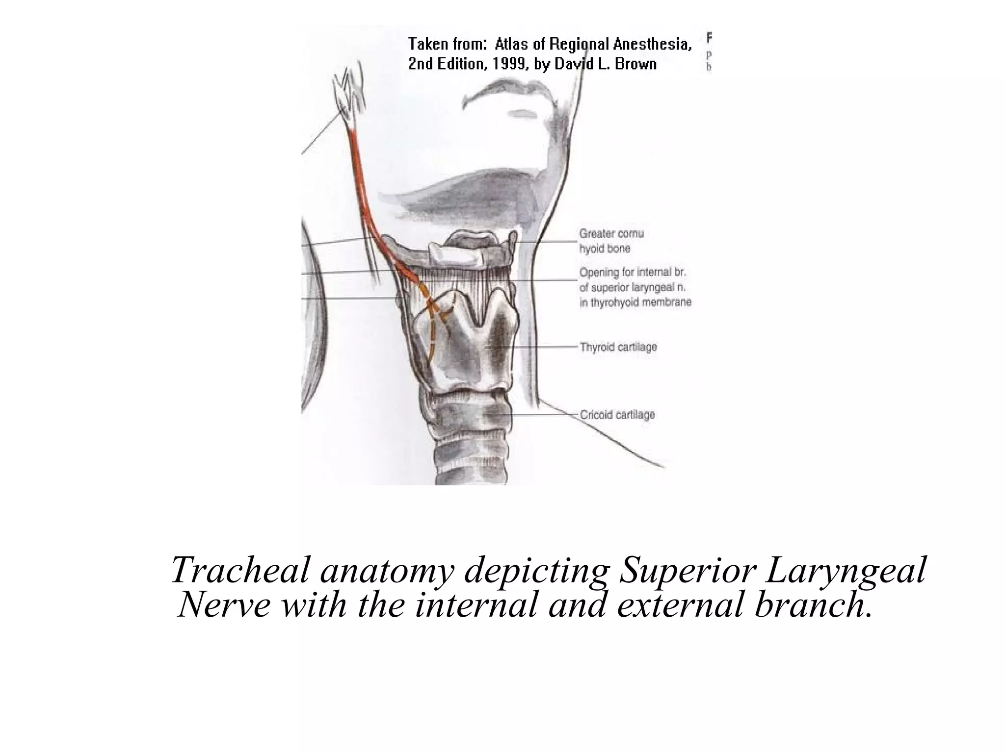 Fiberoptic intubation | PPT
