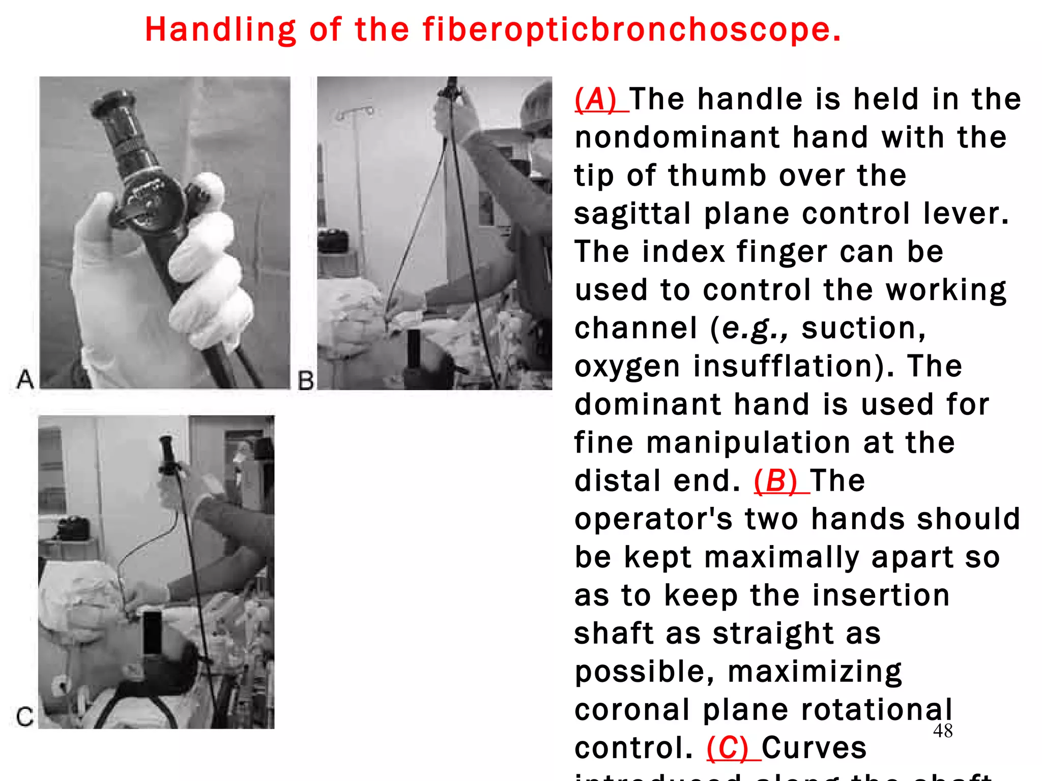 Fiberoptic intubation | PPT