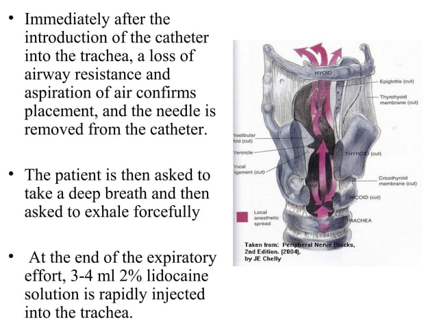 Fiberoptic intubation | PPT