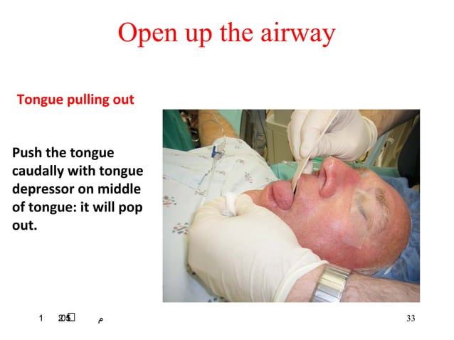 Fiberoptic intubation | PPT