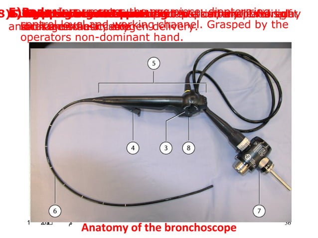 Fiberoptic intubation | PPT