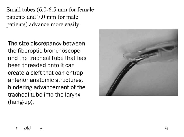 Fiberoptic intubation | PPT