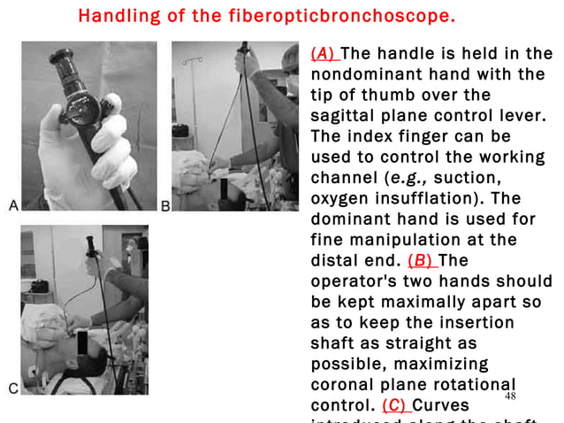 Fiberoptic intubation | PPT