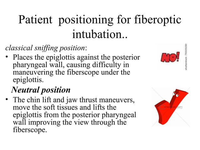 Fiberoptic intubation | PPT