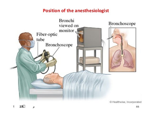 Fiberoptic intubation
