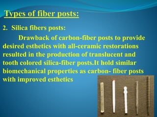 Fiber post | PPTX