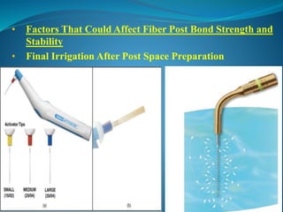 Fiber post | PPTX
