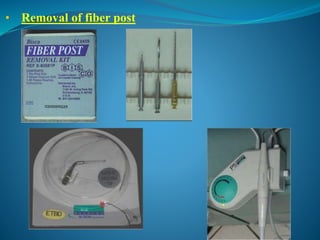 Fiber post | PPTX