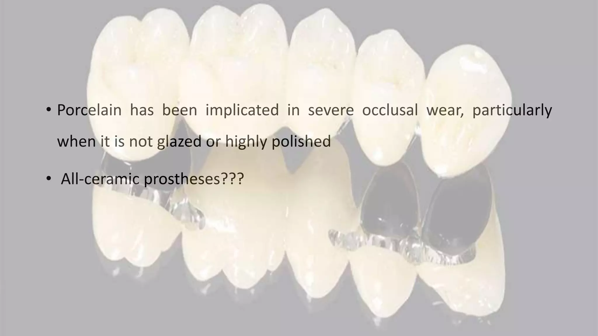 Fiber reinforced composite fixed prosthesis | PPTX