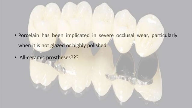 Fiber reinforced composite fixed prosthesis | PPTX