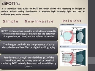 Fibre Odontology | PPT