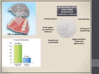 Fibre Odontology | PPT