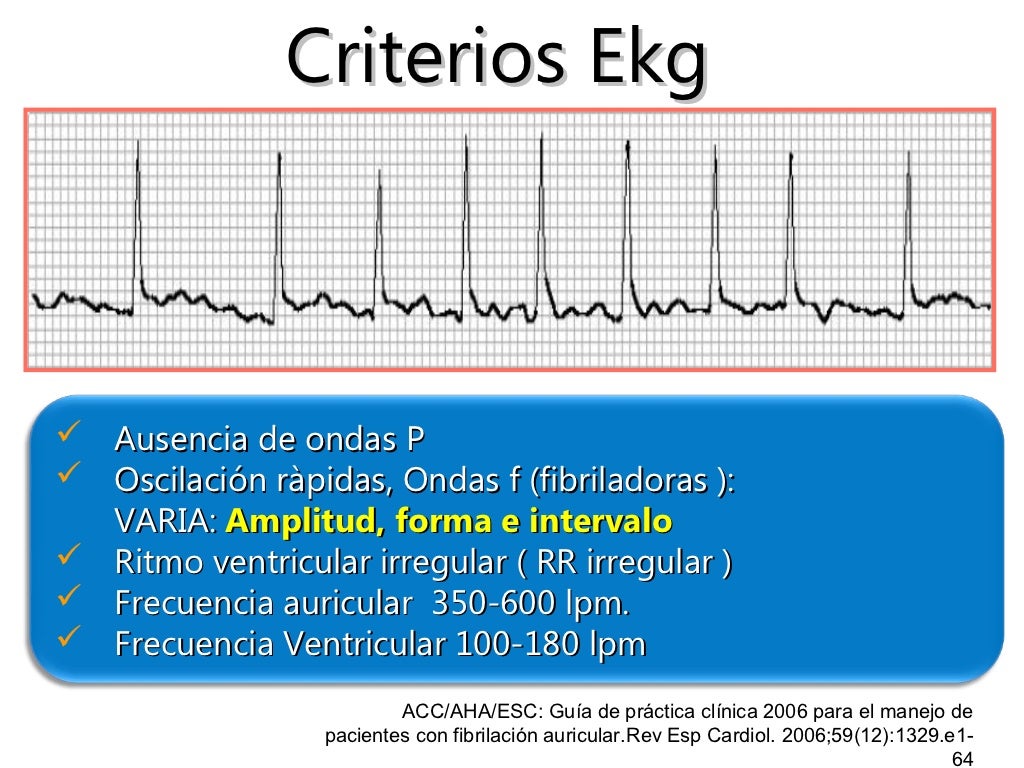 Fibrilación auricular