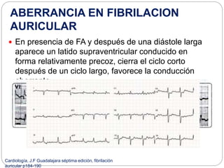 Fibrilacion auricular | PPTX